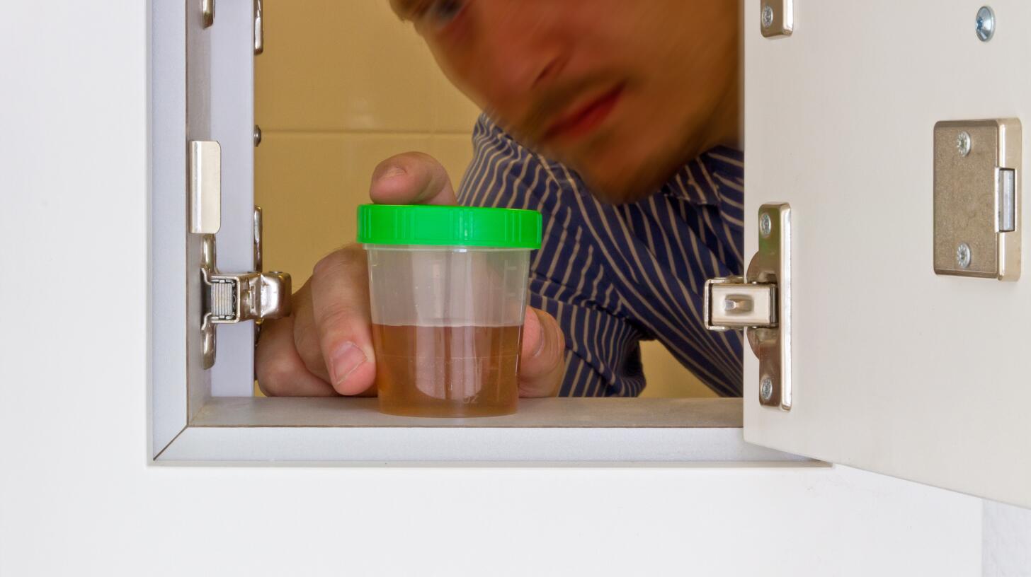 7 Surprising Urinary Tract Facts | Female & Male Urinary Tract