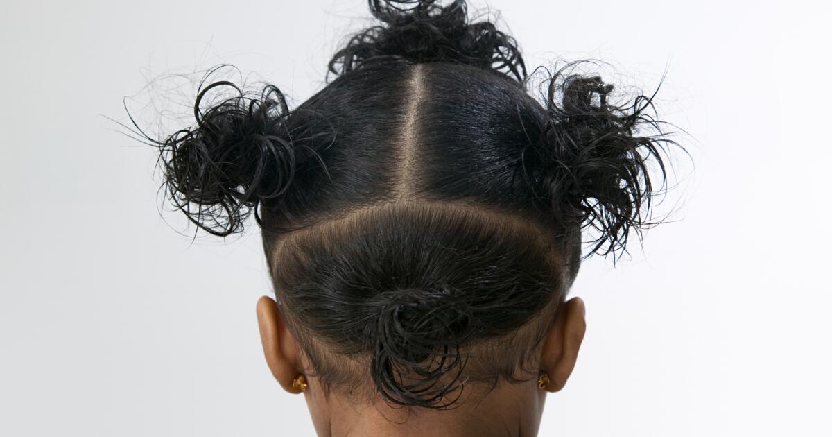 Scalp Symptoms - Symptoms, Causes, Treatments