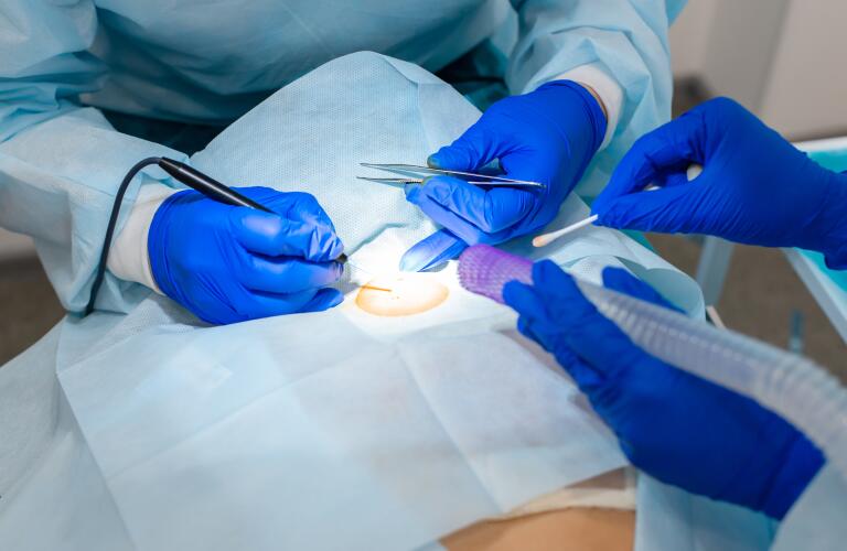 Squamous Cell Carcinoma: A Range of Treatment Options