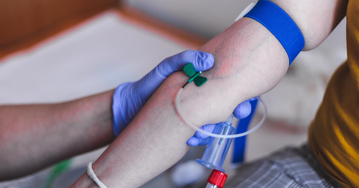 Hemochromatosis Treatment | What to Do for Hemochromatosis
